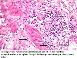 Atlas Praktikum BMD (Patologi Anatomi) (1) (1).pdf