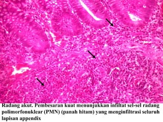 Atlas Praktikum BMD (Patologi Anatomi) (1) (1).pdf