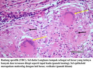 Atlas Praktikum BMD (Patologi Anatomi) (1) (1).pdf