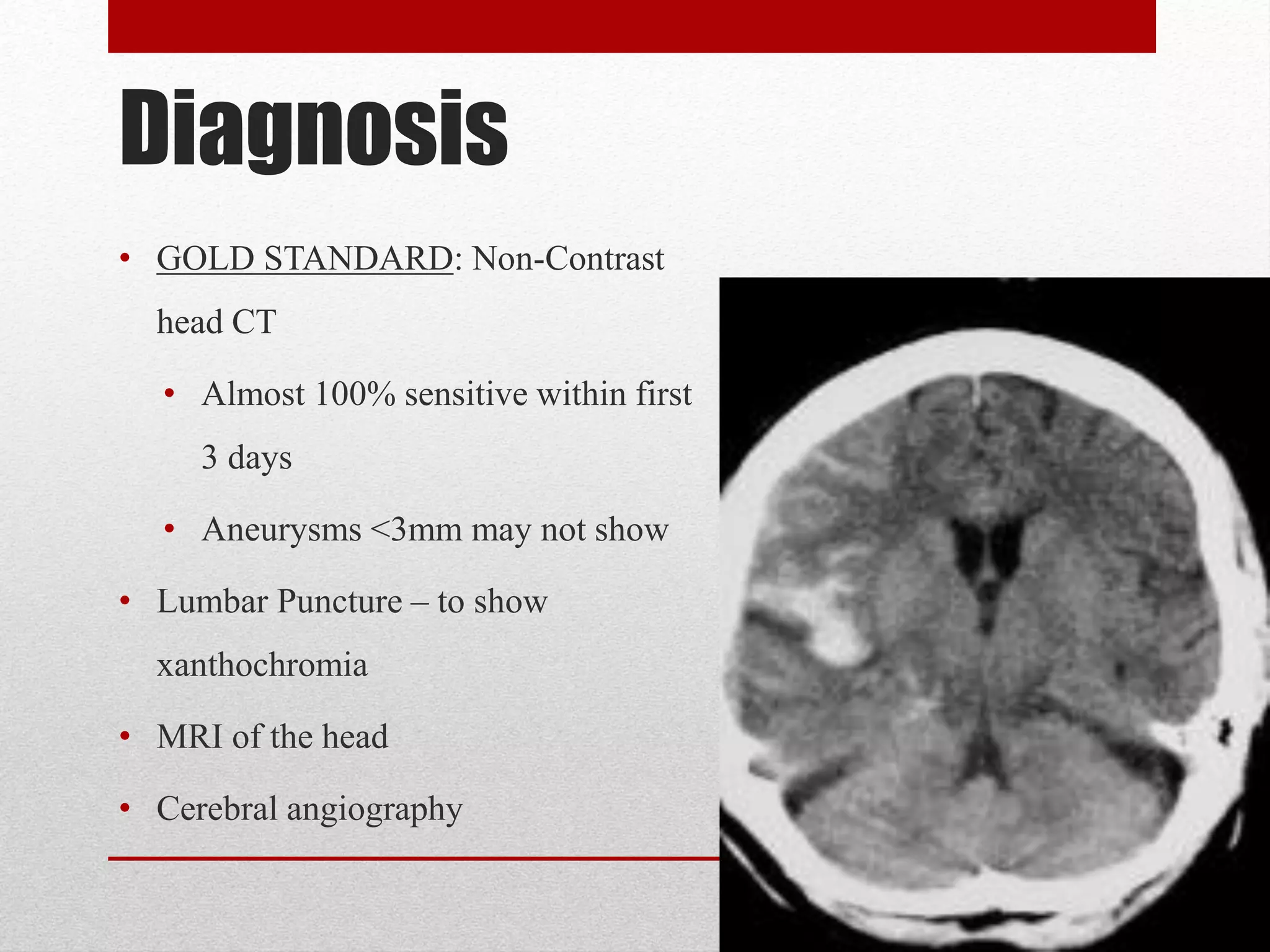 SUBARACHNOID HEMORRHAGE | PDF