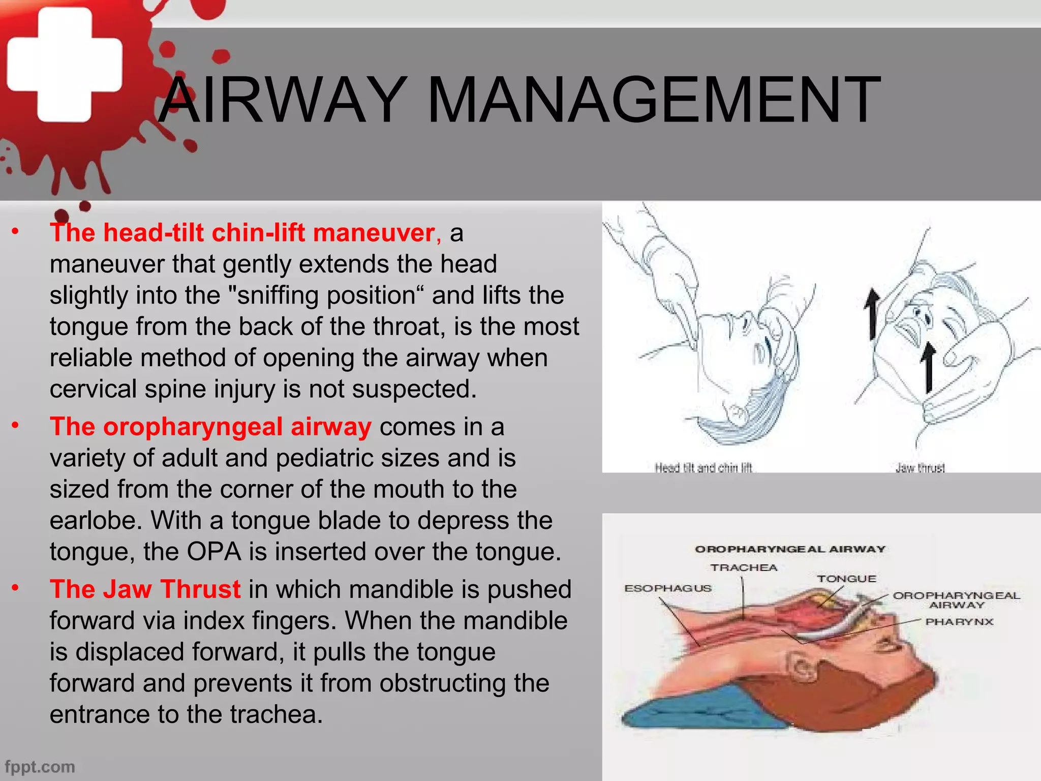 ATLS (Advance Trauma Life Support) | PPT