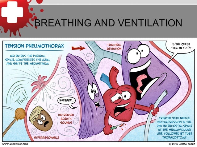 ATLS (Advance Trauma Life Support) | PPT