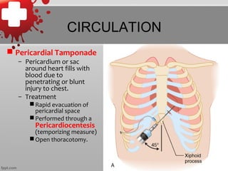 ATLS (Advance Trauma Life Support) | PPT