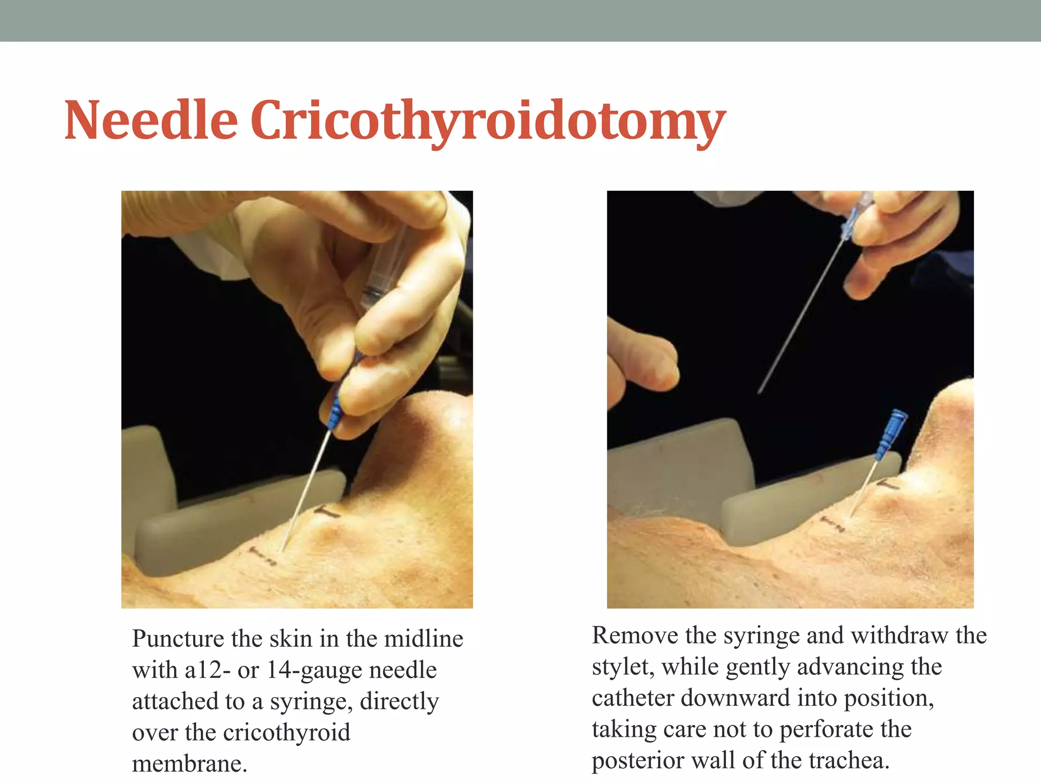 advanced trauma life support | PPTX