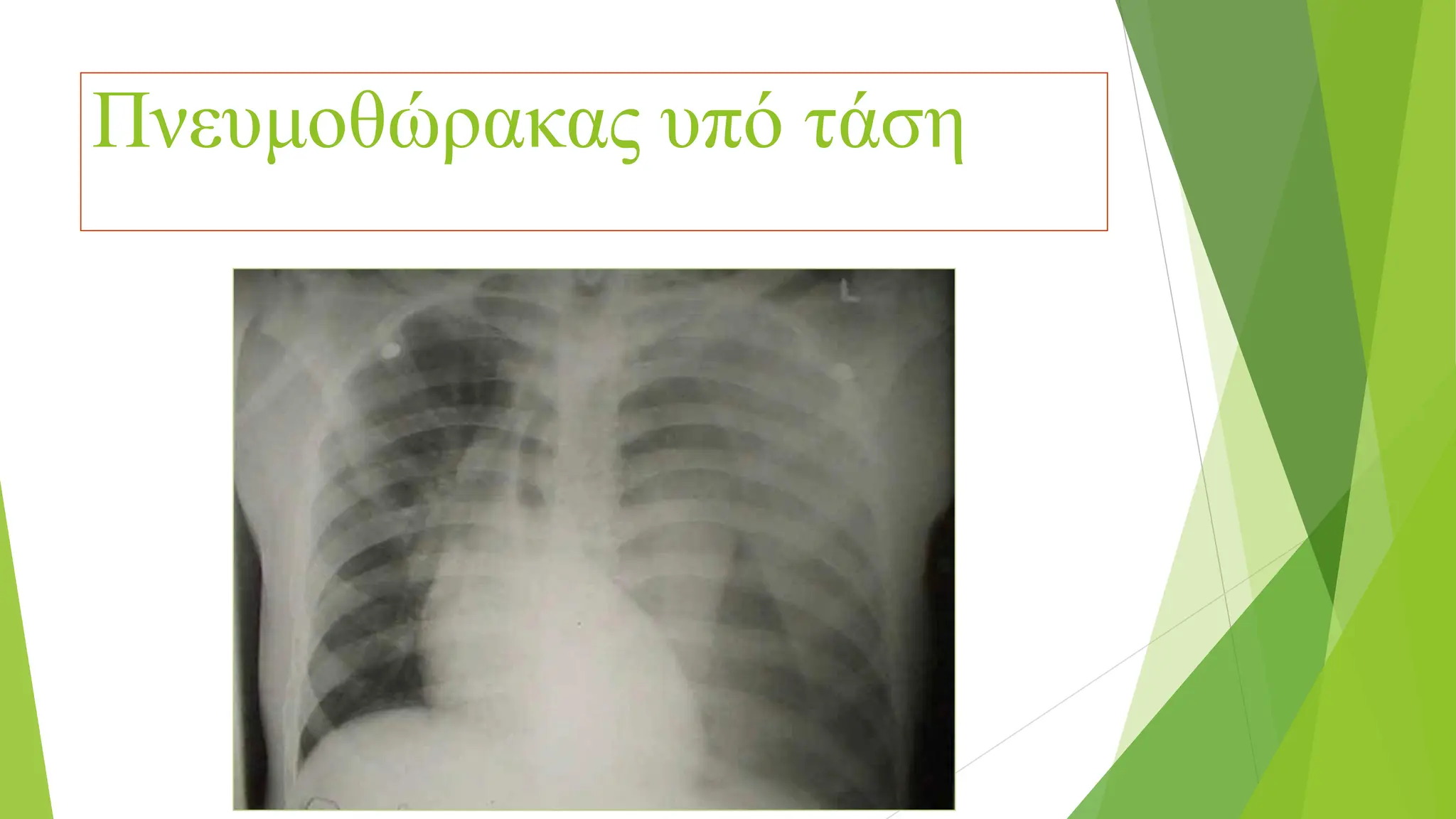 Εισαγωγή στο ATLS.pdf ADVANCE TRAUMA LIFE SUPPORT | PPT