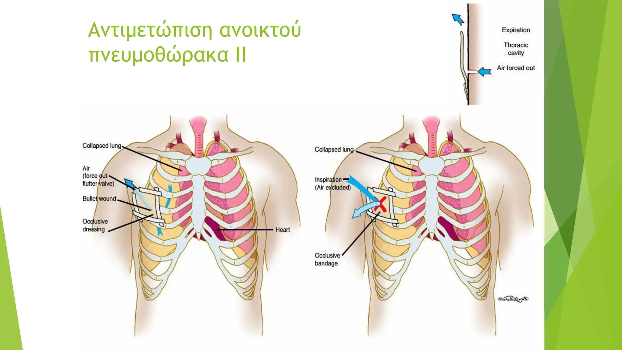 Εισαγωγή στο ATLS.pdf ADVANCE TRAUMA LIFE SUPPORT | PPT