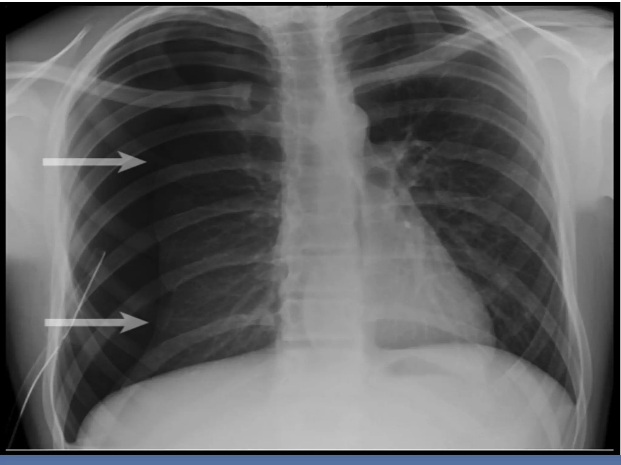 ATLS initial assessment 2019 | PDF