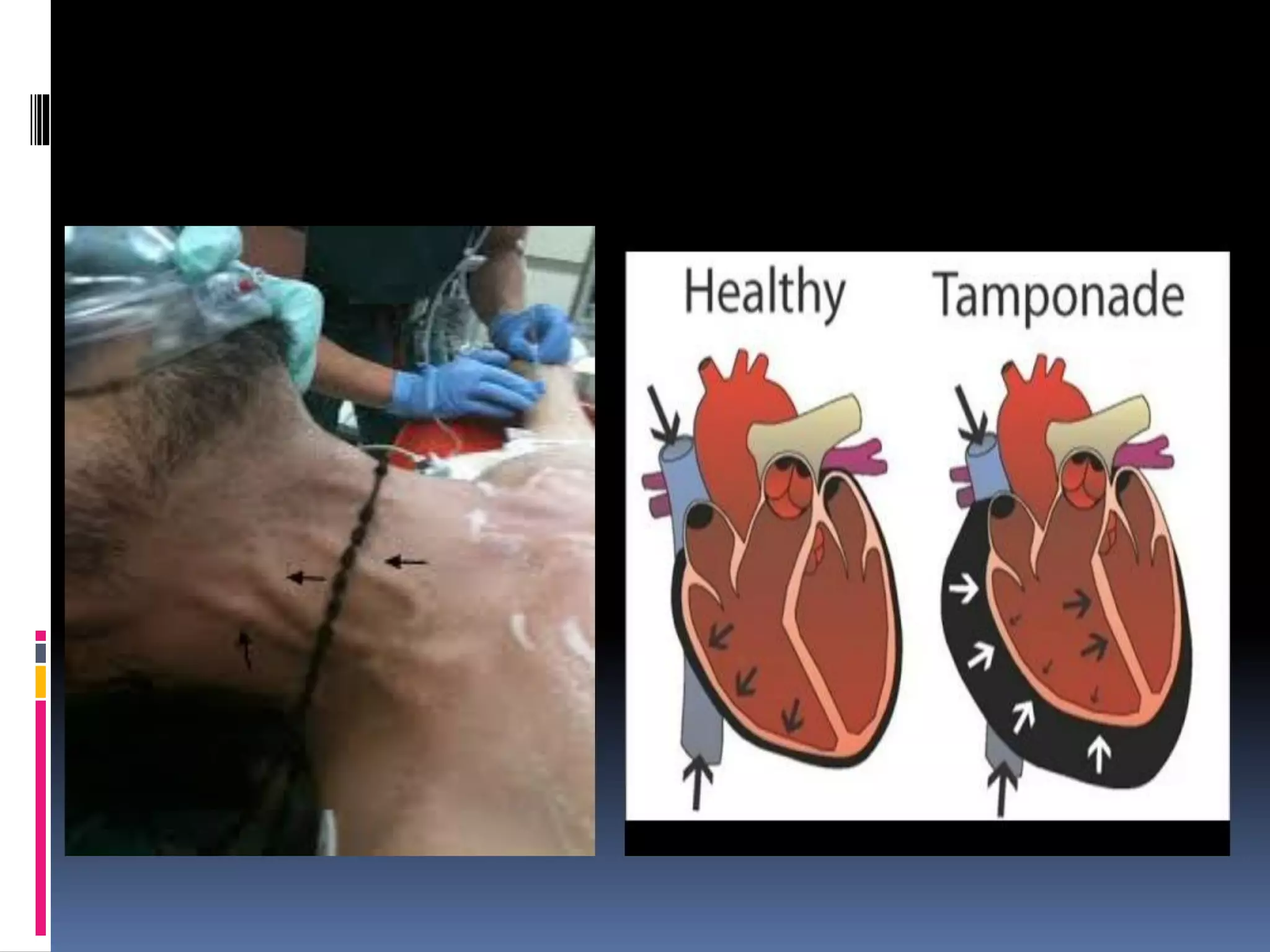 ATLS initial assessment 2019 | PDF