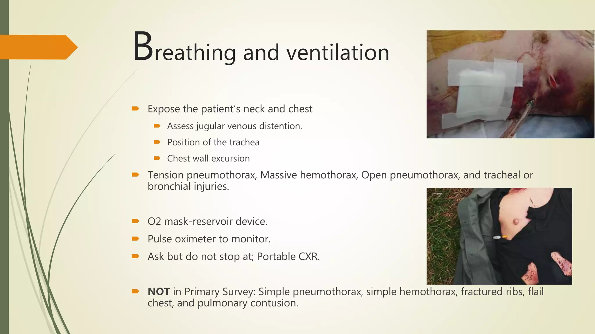 Atls; Advanced Trauma Life Support | PPTX