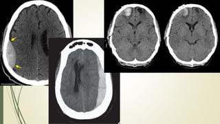 Atls; Advanced Trauma Life Support | PPTX