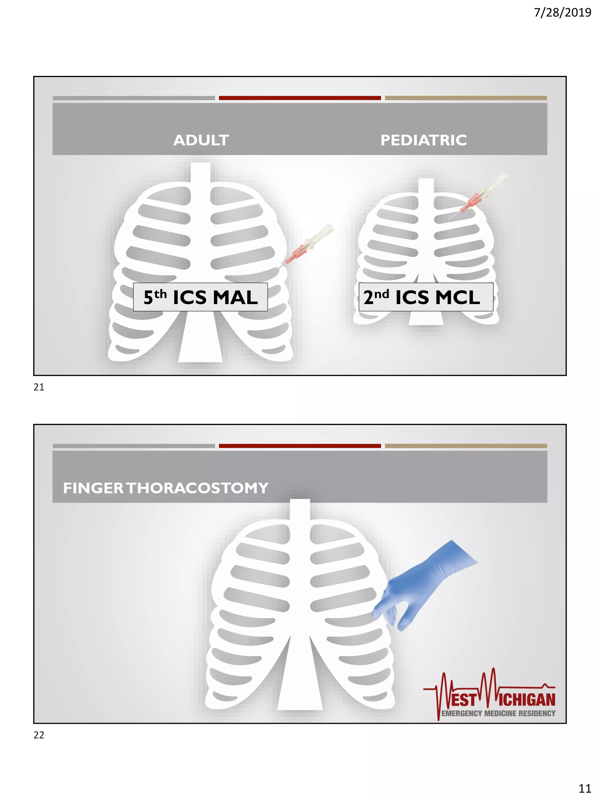 Atls 10 th updates | PDF