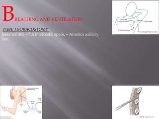 Atls (advance trauma life support) PRIMARY SURVEY | PPTX