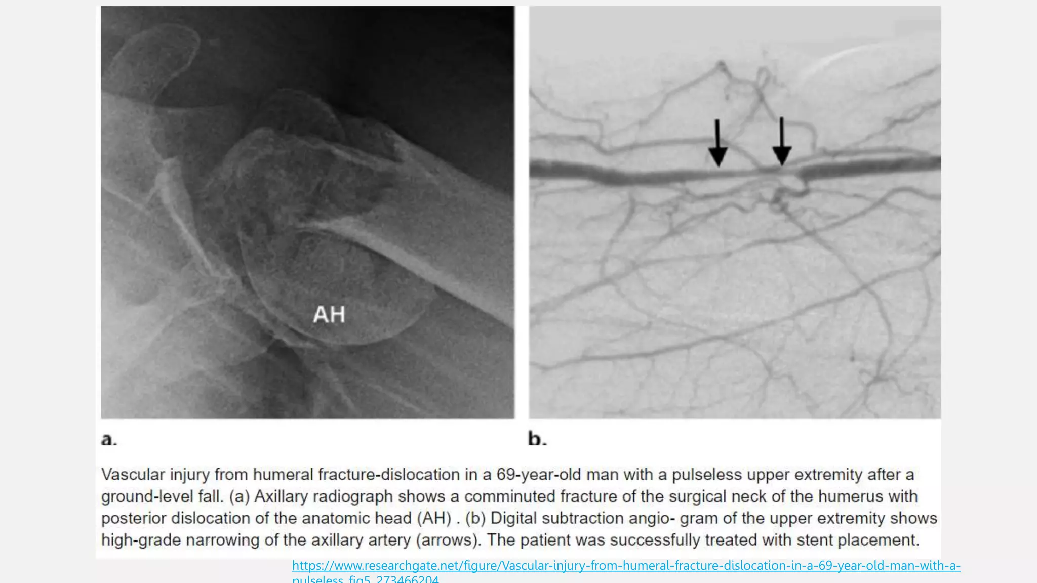 ATLS BAB 8 - Musculoskeletal Trauma Injuries.pptx