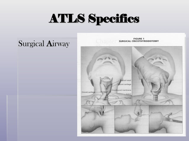 ATLS Advance trauma life support golden hour concept.ppt | First Aid ...