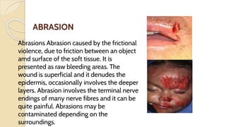 Maxillofacial Trauma and Its Emergency Management | PPTX