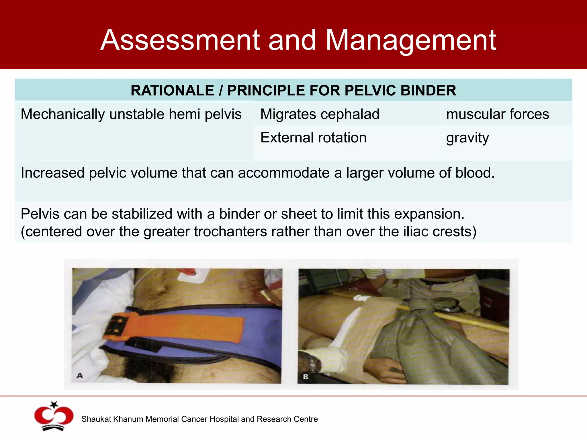 Abdominal and Pelvic Trauma | PPTX