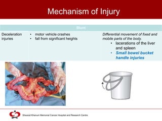 Bucket Handle Injury