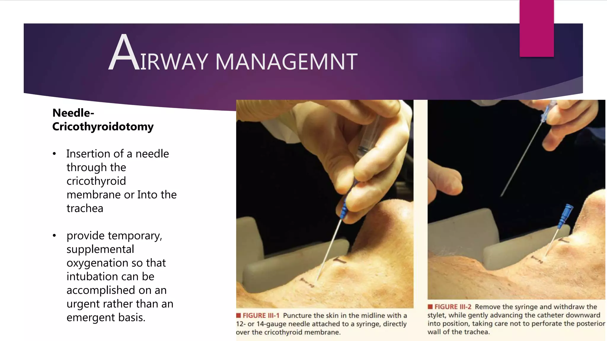 Atls presentation | PPTX