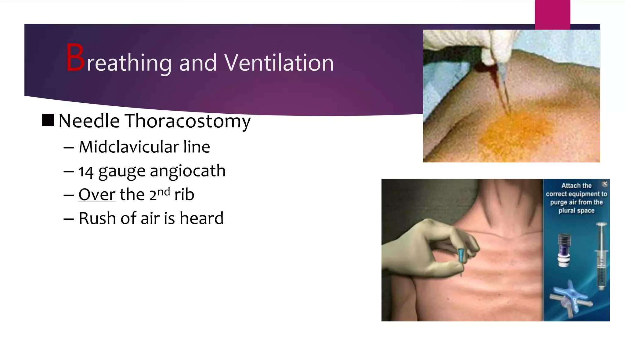 Atls presentation | PPTX