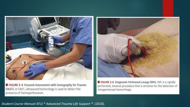 ATLS Protocol.pptx | First Aid | Injuries