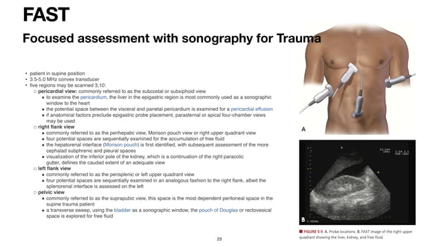Approach to a trauma patient - Advanced Trauma Life Support | PDF ...