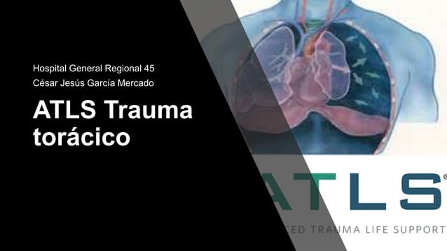 Atls trauma torax | PPT