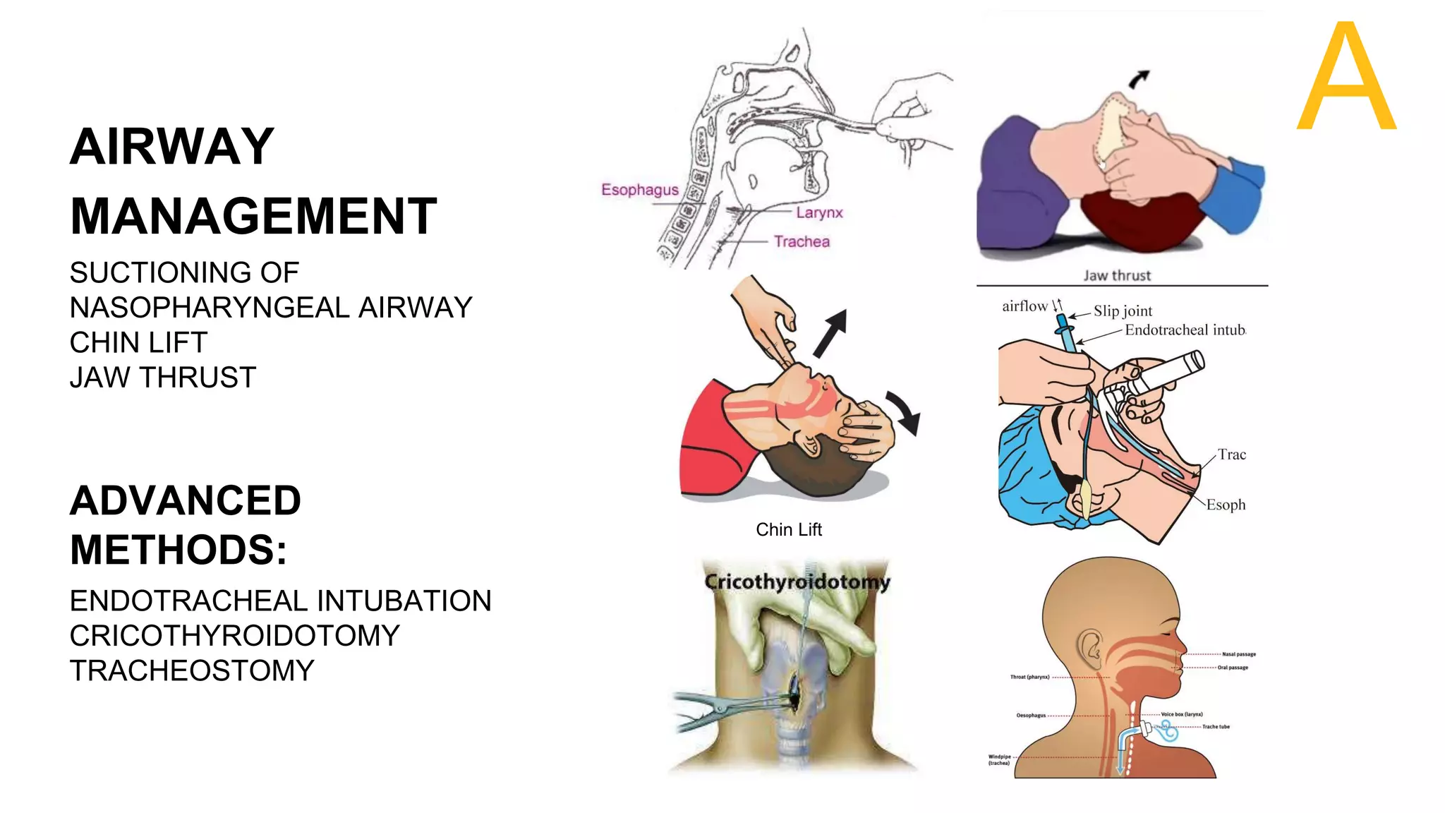 ATLS (Advanced Trauma Life Support) | PPTX