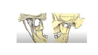 Anatomia de la Articulación TemporomandibularATM.pptx