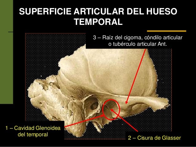 ARTICULACION TEMPORO MANDIBULAR