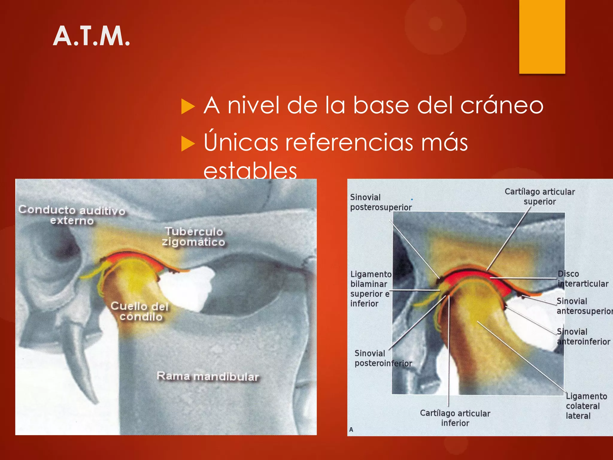 Anatomía de la ATM | PDF