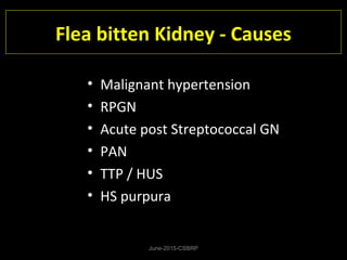 Flea Bitten Kidney