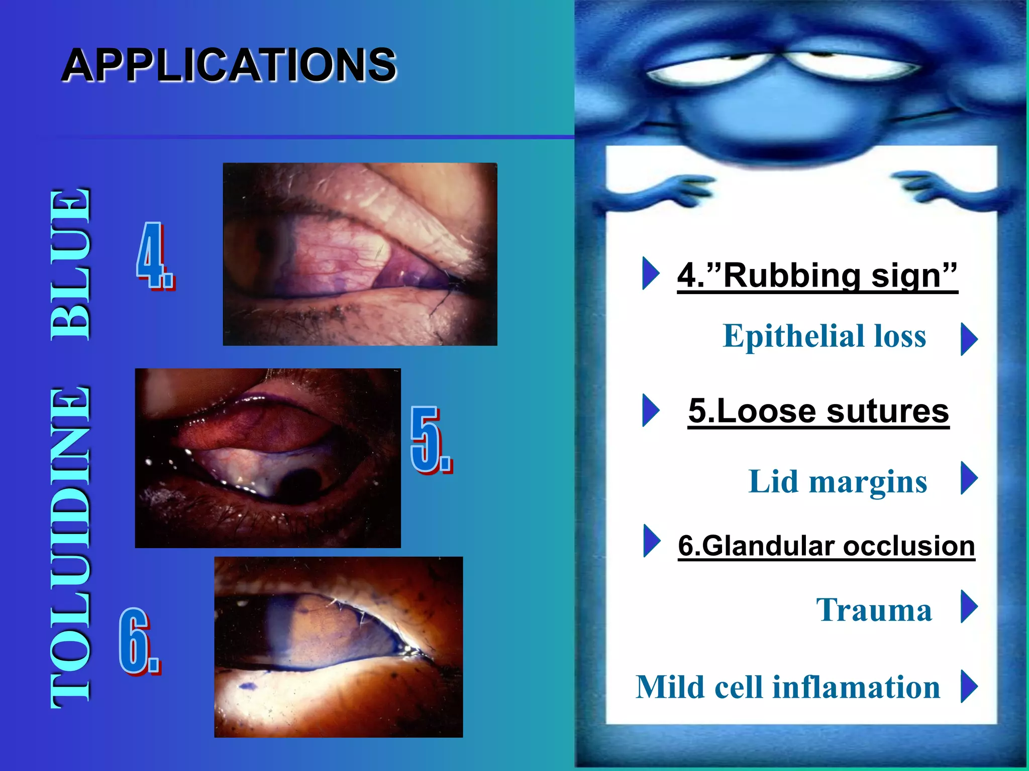 TOLUIDINE BLUE | PDF