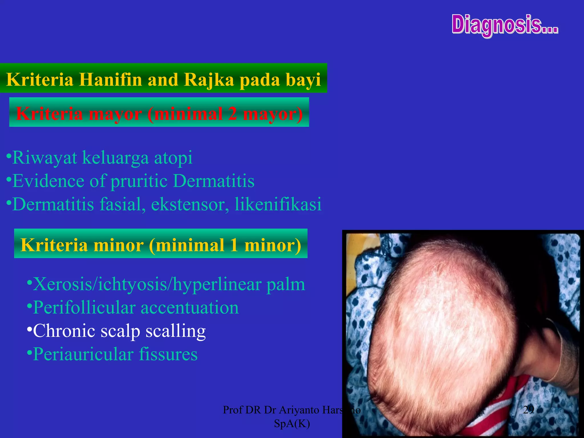 Atopic dermatitis | PPT