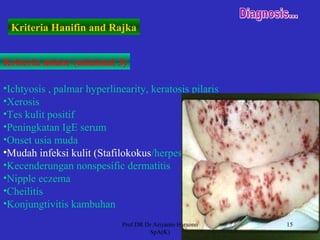 Atopic dermatitis | PPT