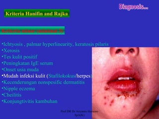 Atopic dermatitis | PPT