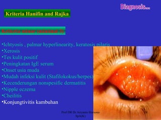 Atopic dermatitis | PPT