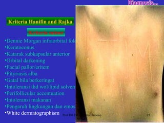 Atopic dermatitis | PPT