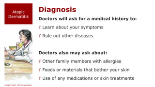 Atopic Dermatitis | PPTX