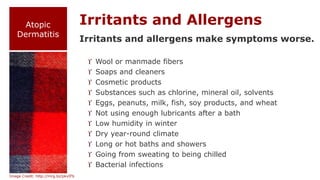 Atopic Dermatitis | PPTX