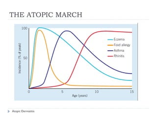 Atopic dermatitis | PDF