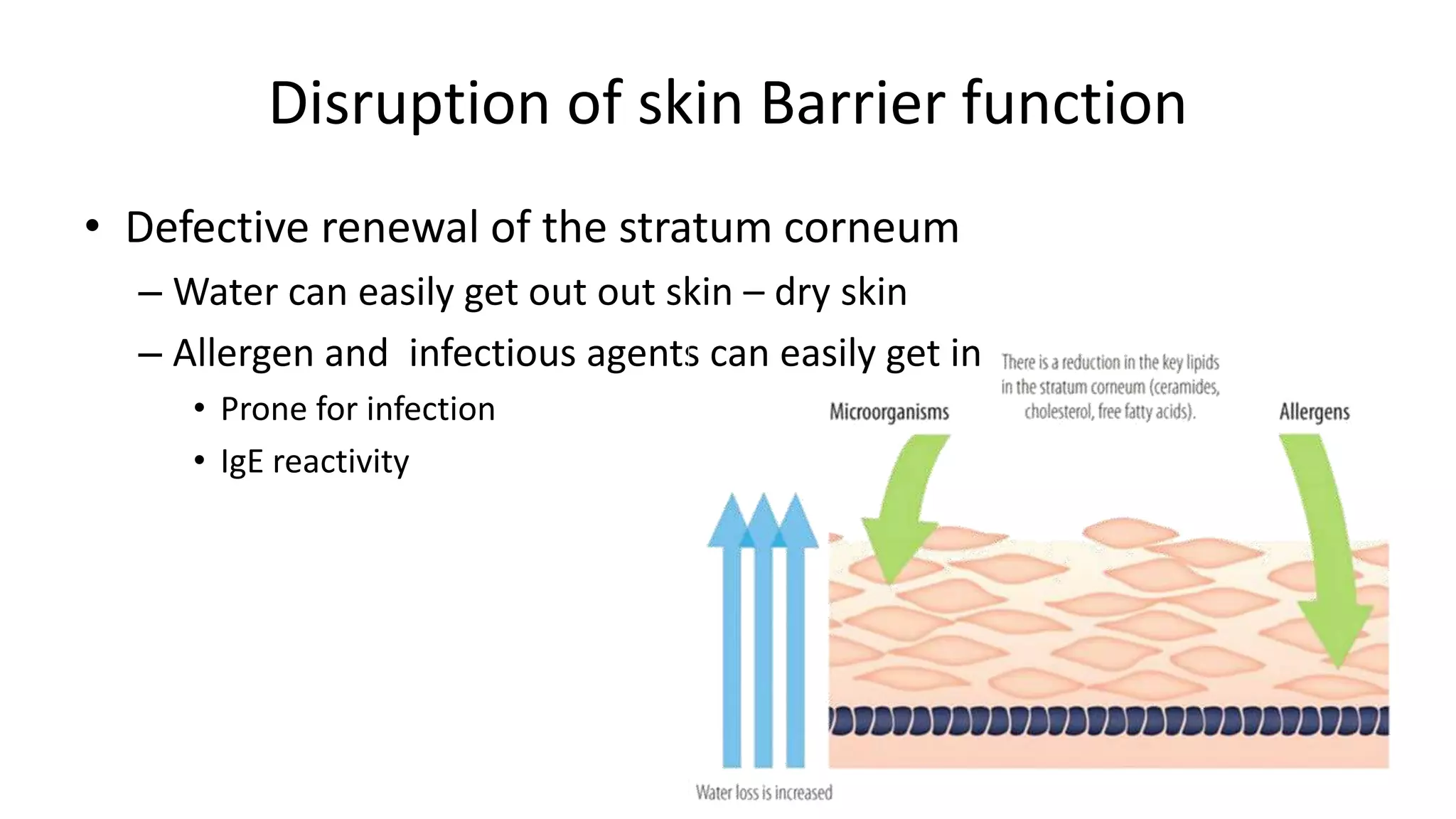 Atopic dermatitis | PPTX