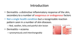 Atopic dermatitis | PPTX