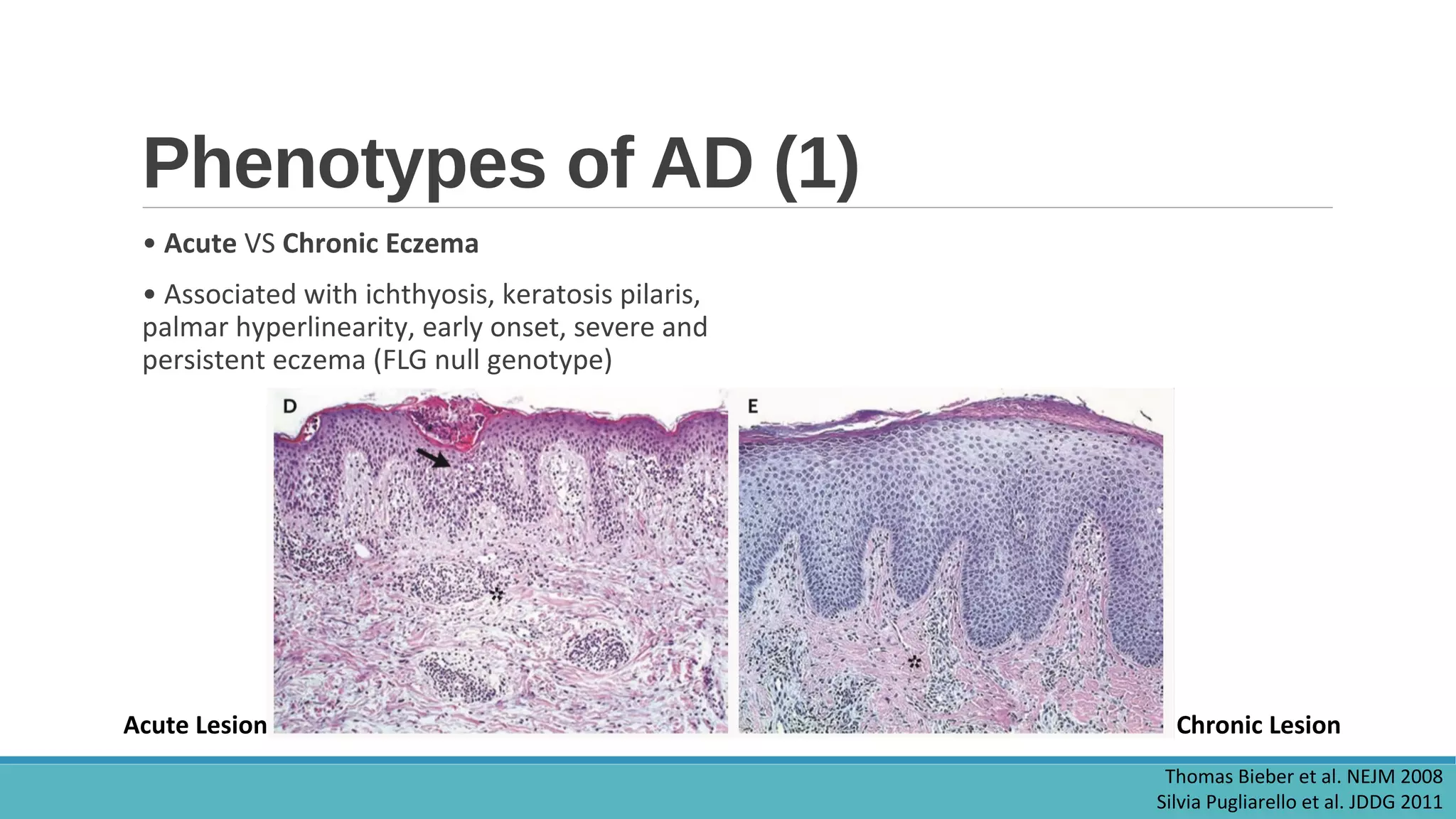 atopicdermatitis-190308055304 (1).pdf