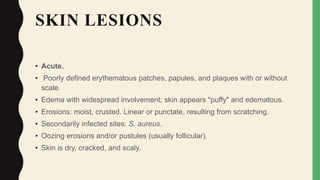 Atopic dermatitis | PPTX | Skin and Dermatology | Diseases and Conditions