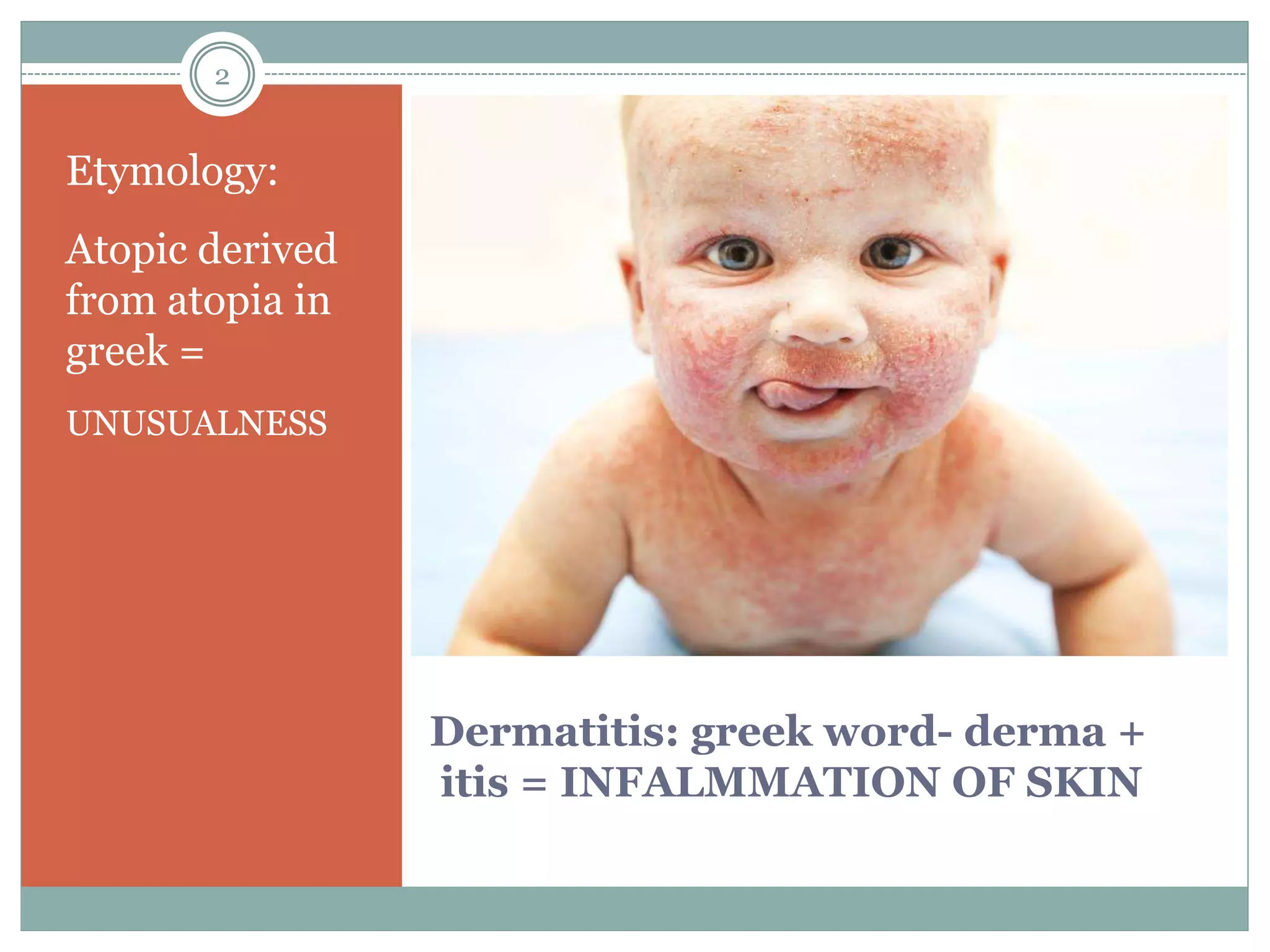 Atopic dermatitis | PPTX