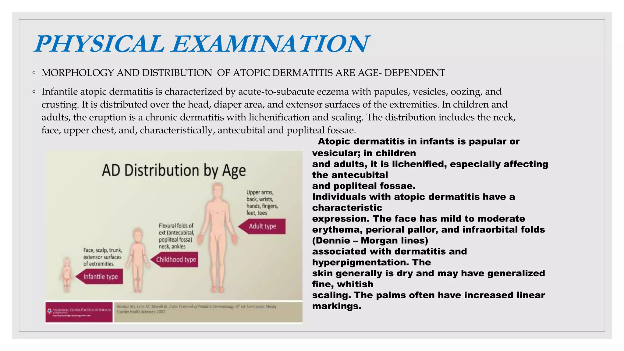 ATOPIC DERMATITIS.pptx