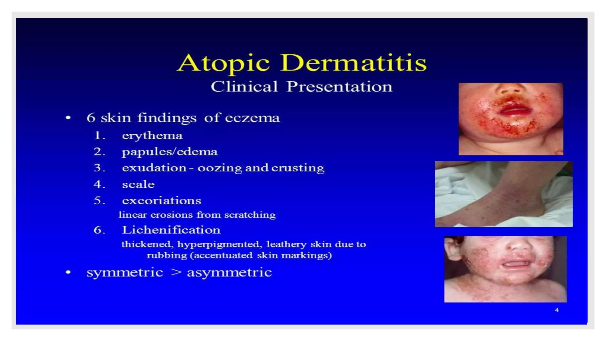 ATOPIC DERMATITIS.pptx