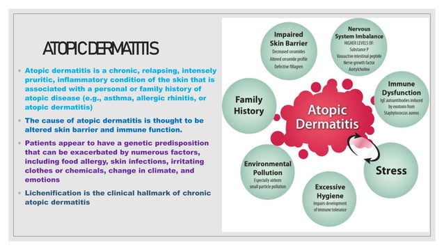 ATOPIC DERMATITIS.pptx