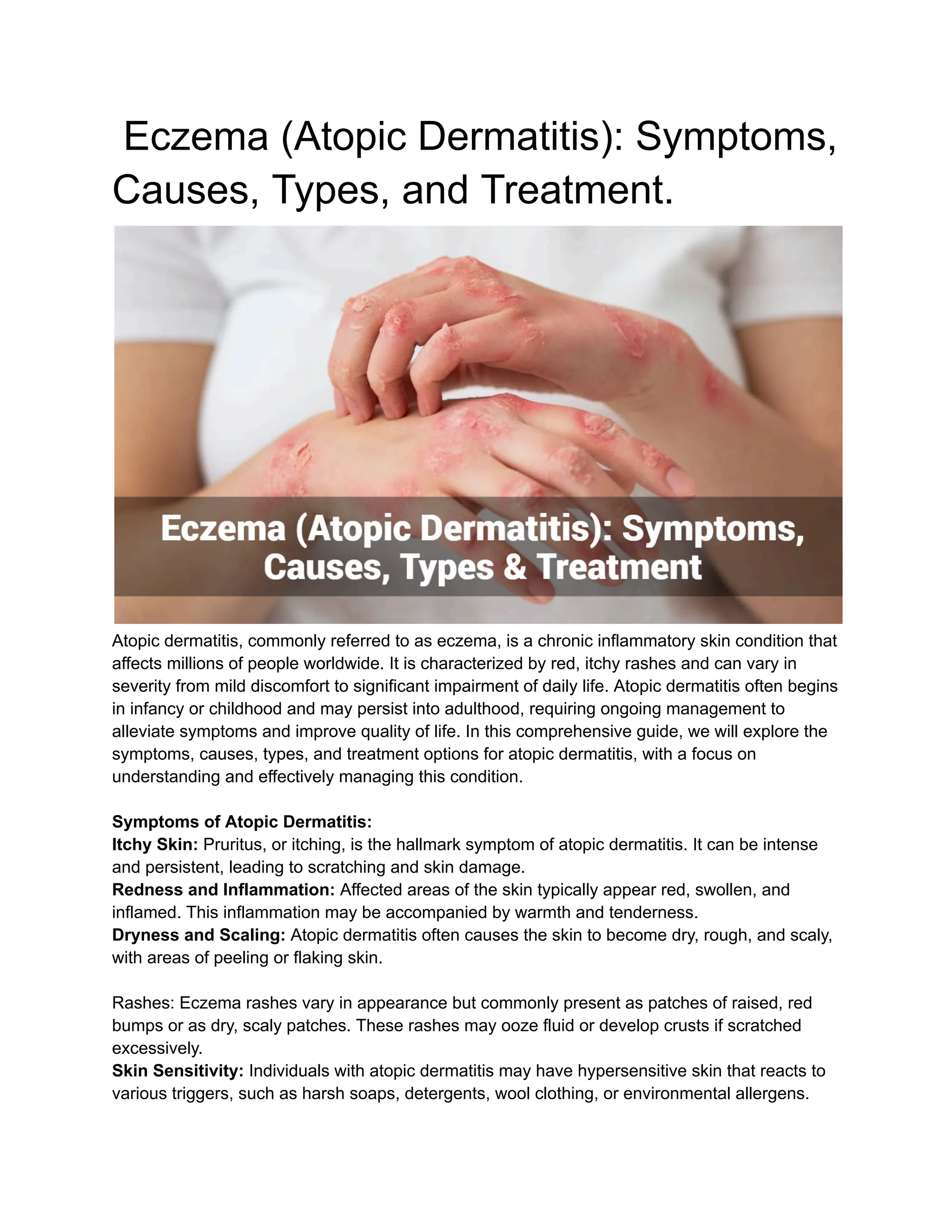 Eczema (Atopic Dermatitis): Symptoms, Causes, Types, and Treatment | PDF
