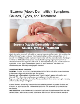 Eczema (Atopic Dermatitis): Symptoms, Causes, Types, and Treatment | PDF
